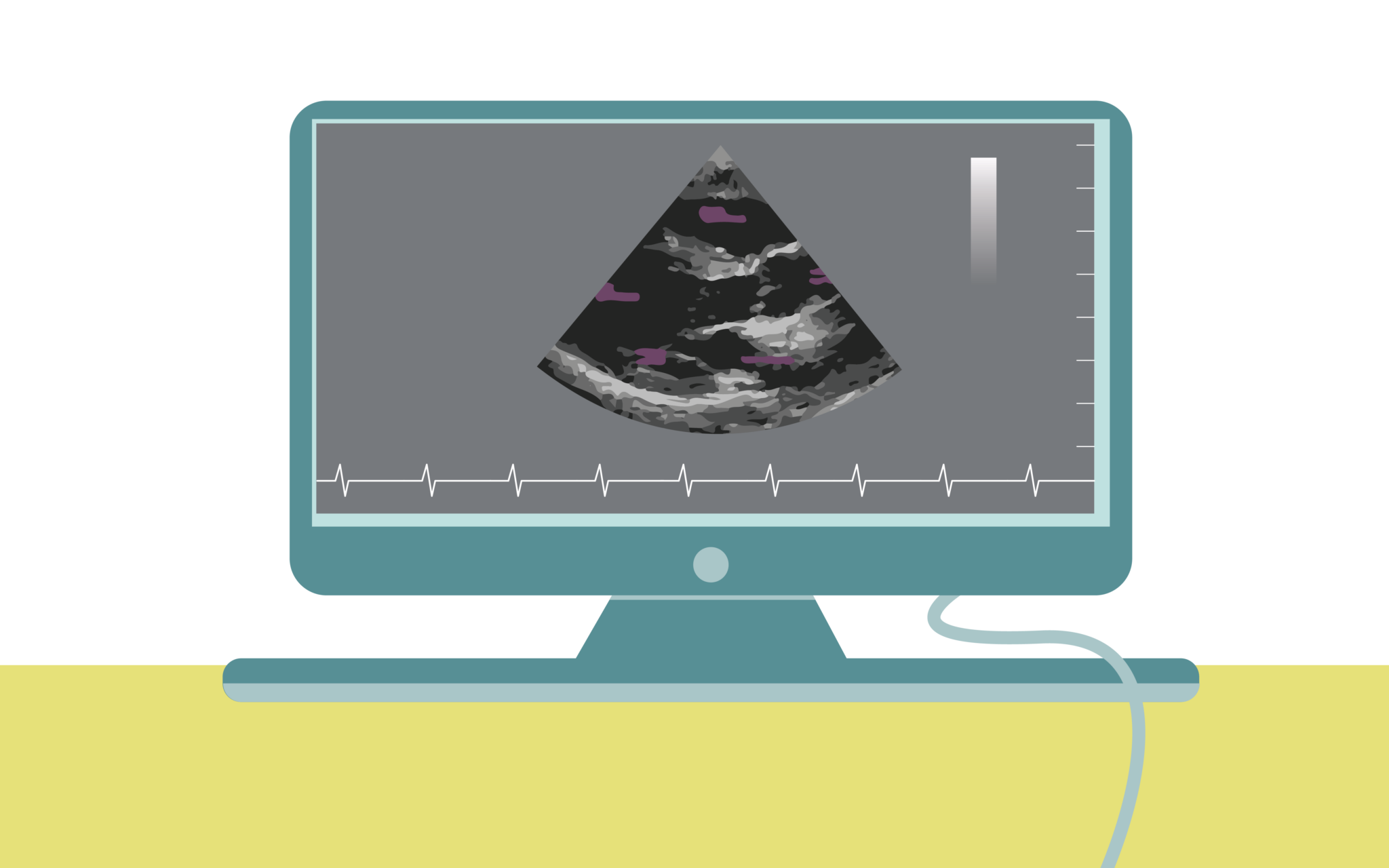 Module One: Understanding Your Diagnosis – myactioneducation.org