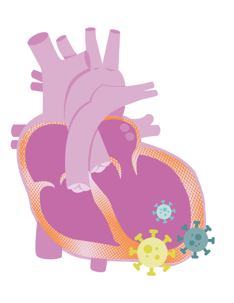 Cardiomyopathy – myactioneducation.org