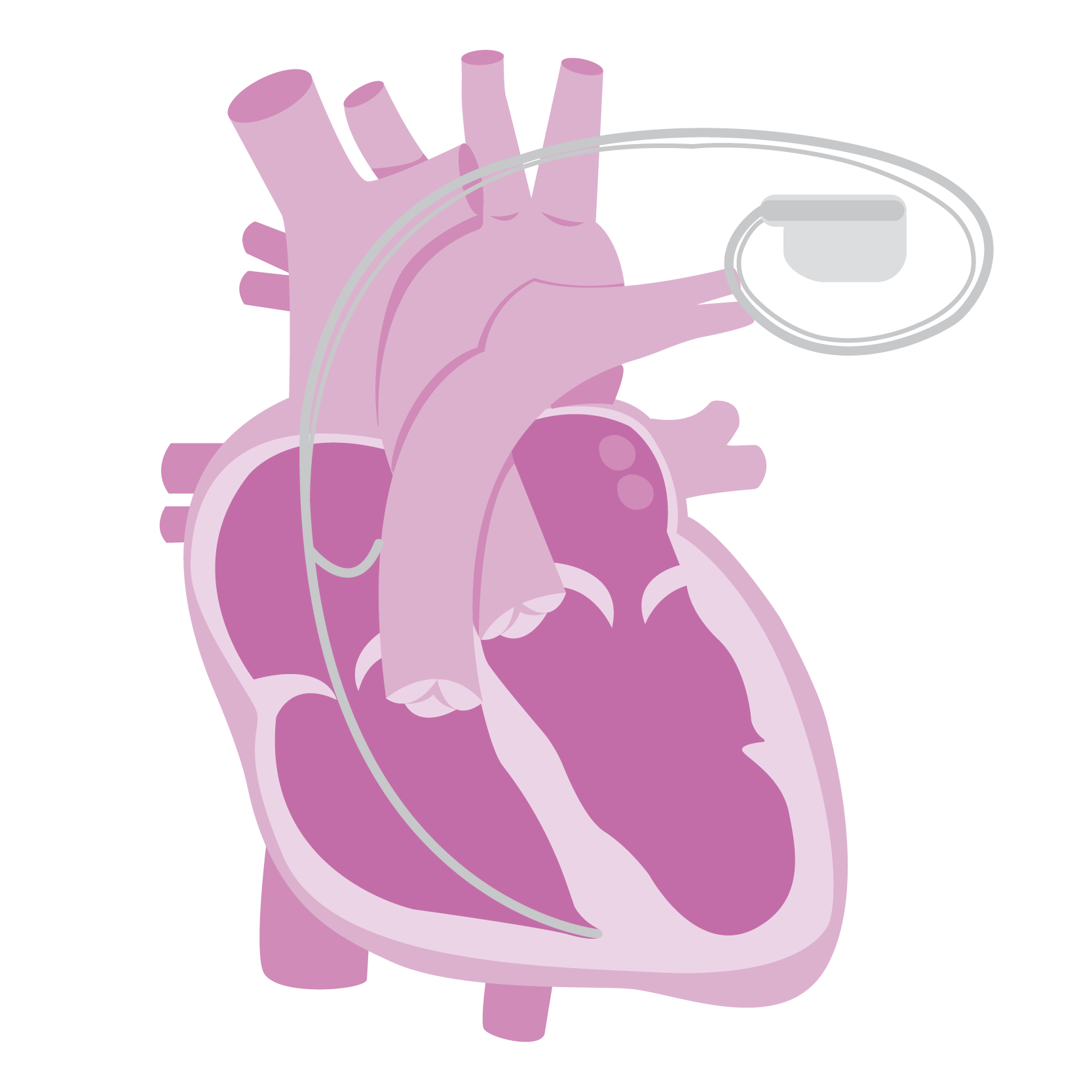 Module Three: Knowing Your Device and Understanding Surgery ...