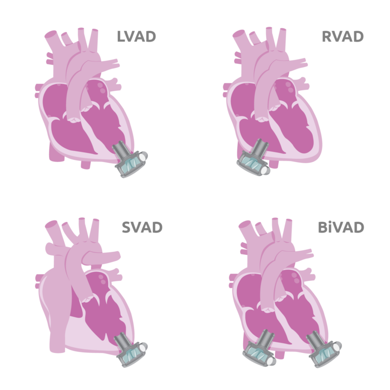 Module Three: Knowing Your Device and Understanding Surgery ...