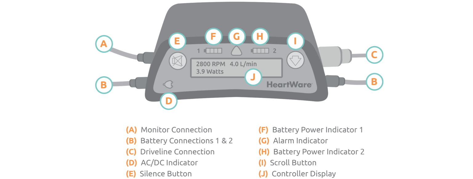 Medtronic™ HVAD – myactioneducation.org
