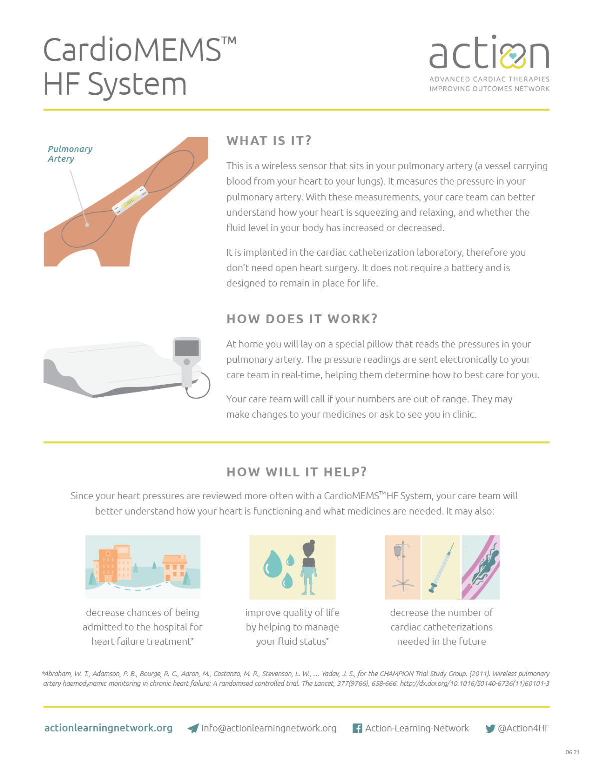 CardioMEMs – myactioneducation.org